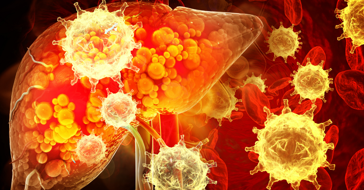 A new therapy for liver cancer